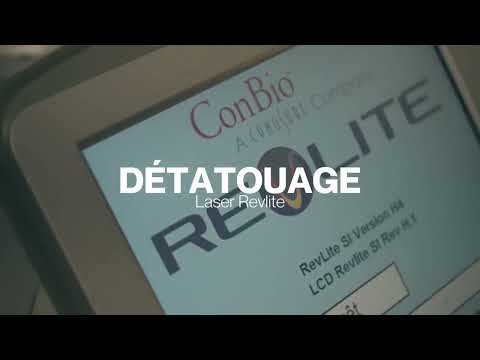 Détatouage au laser - Institut Audrey Sylvestre